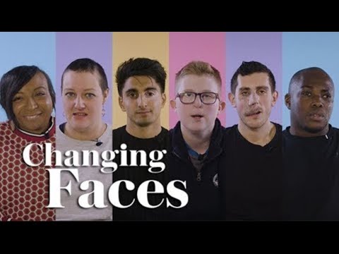 Living with a Visible Difference | Changing Faces - YouTube