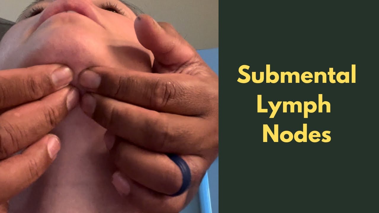 Lymph node: Submental-Where is it? What Does Swelling Mean? - YouTube