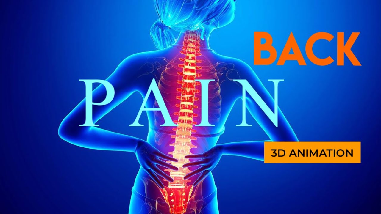Back Pain | 3d animation | - YouTube