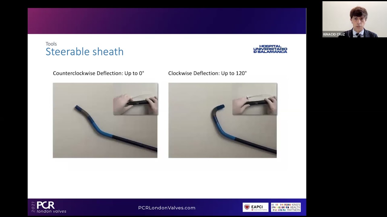 FEops HEARTguide the novel pre-operative planning tool in Abbott ...