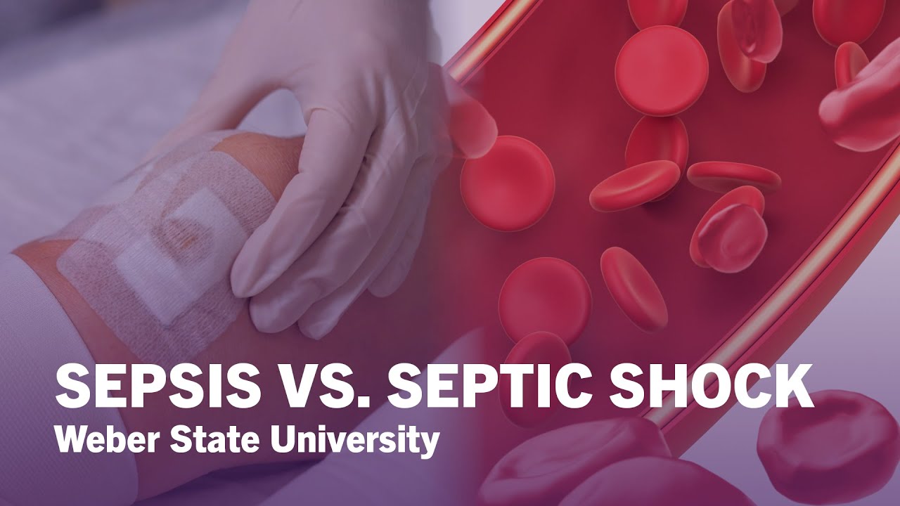 Sepsis vs. Septic Shock - Weber State University - YouTube
