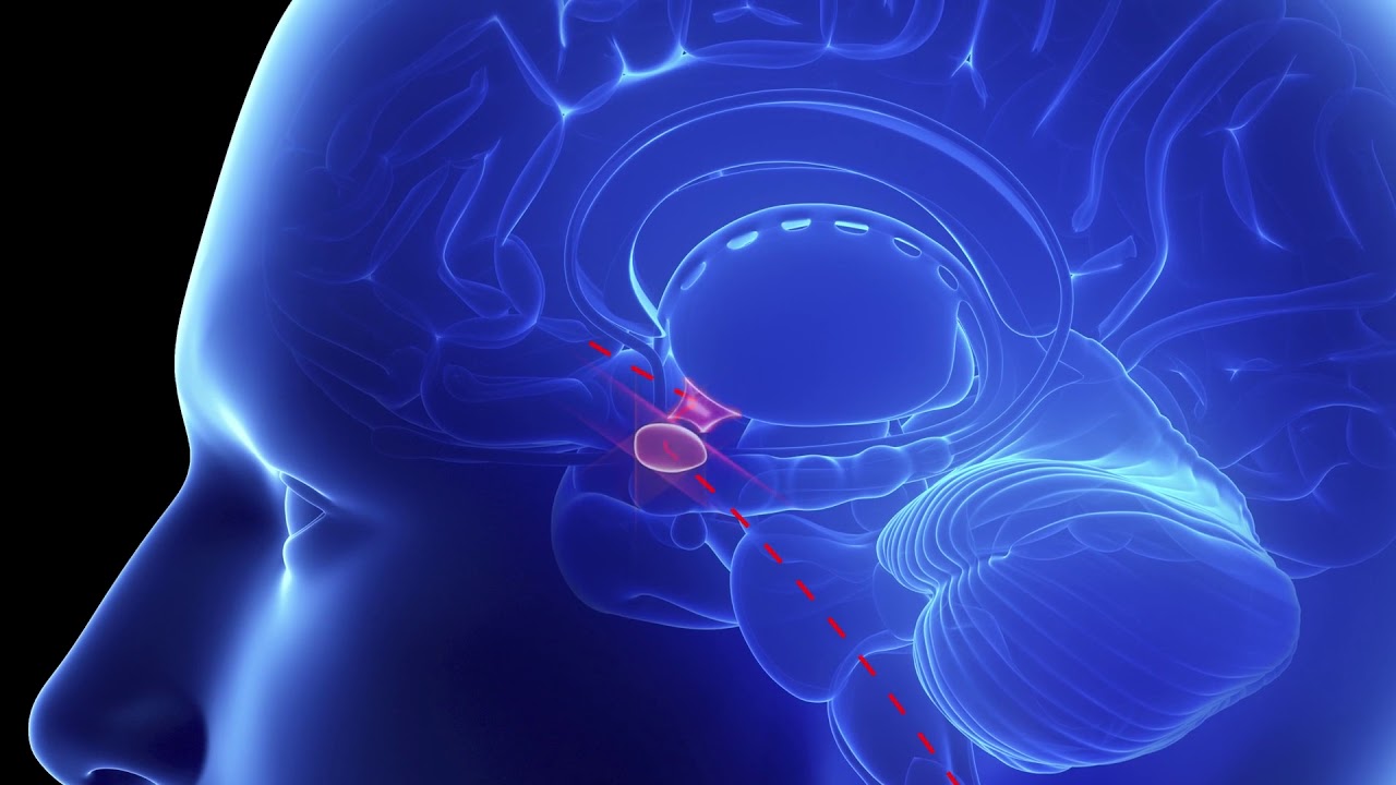 NSS-2 Bridge Device Device Method of Action - YouTube