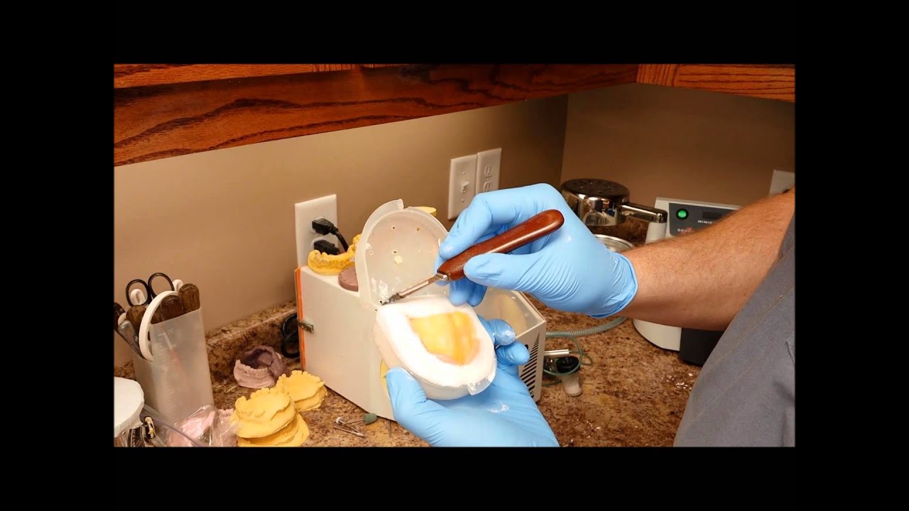 Duplicate denture impression Part 1 - YouTube