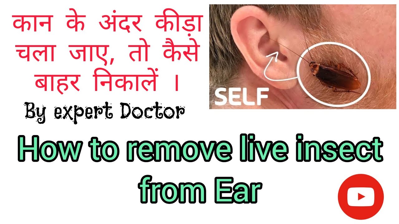 How to remove insect from ear kan se kida kaise nikale kaam se pani ...