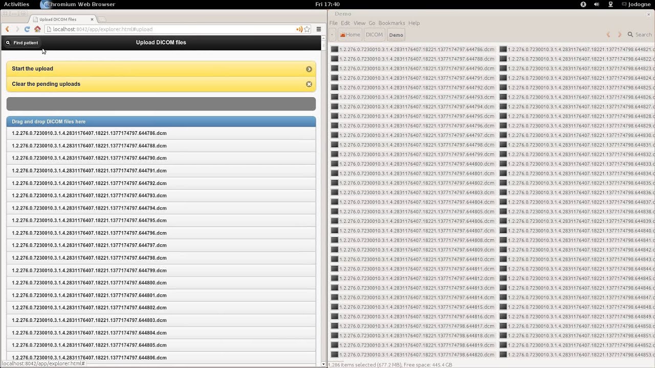 Uploading Dicom Files To Orthanc From A File Browser Youtube