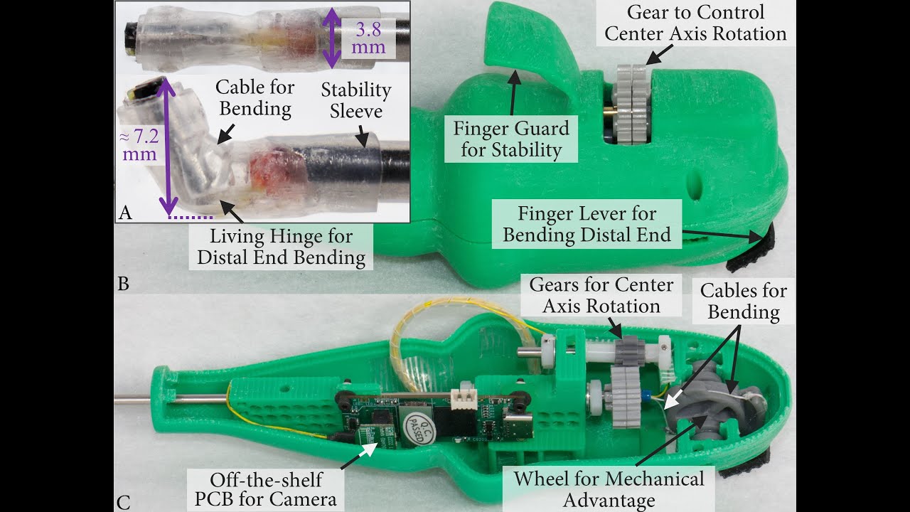AMTL - A Novel Articulating Chip–on–Tip Endoscope for Dynamic Middle ...