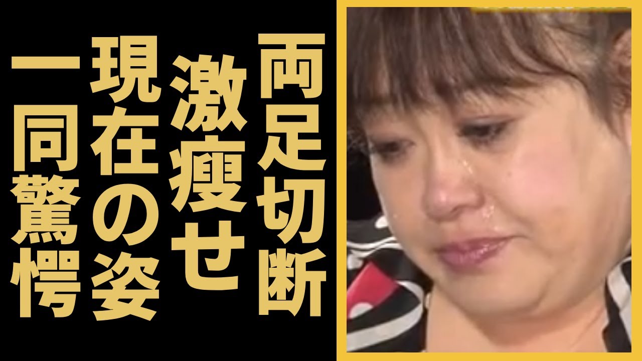 森公美子に降り掛かった悲劇の真相や現在の両足切断の姿に涙が止まらないオペラ歌手「モリクミ」が交通事故で頭部を強打、12年間も言葉を話せず車椅子生活を介護し続ける姿に涙が溢れる
