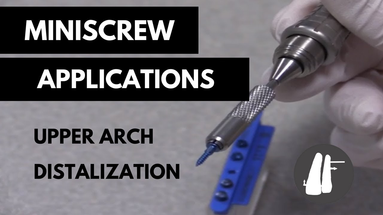 Miniscrew Applications: Upper Arch Distalization|Essential Biomechanics ...