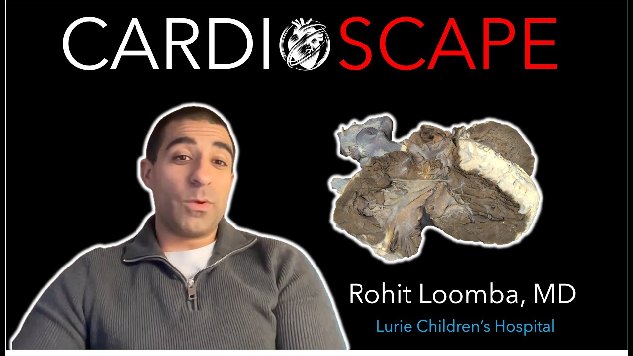 CARDIOSCAPE - Rohit Loomba MD, Lurie Children's Hosptital - YouTube