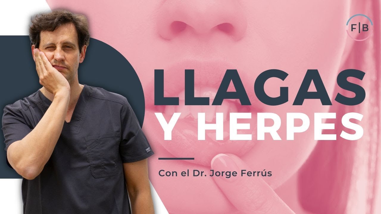👉¿LLAGA o HERPES LABIAL? Diferencias y cómo CURARLO - YouTube