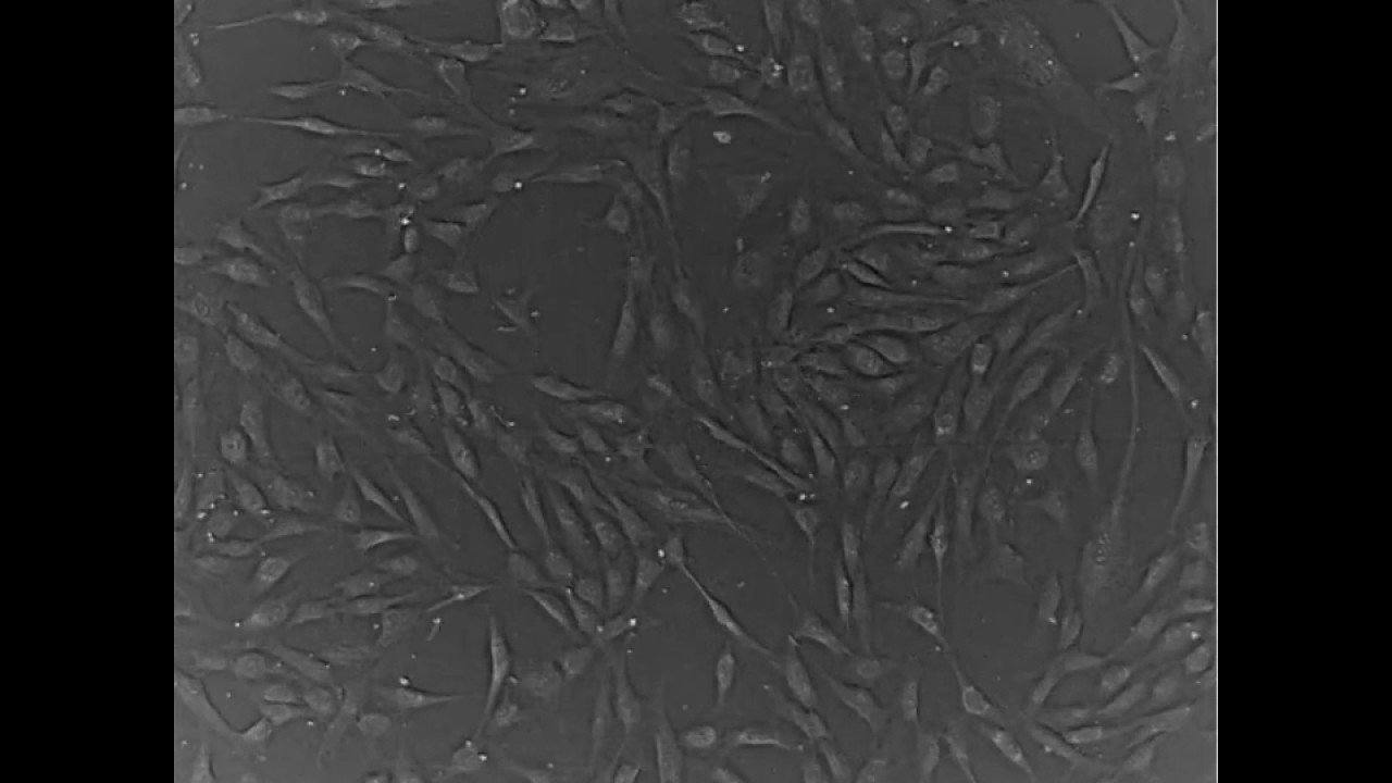 Time Lapse Video of MSC in 2 D Cell Culture - YouTube