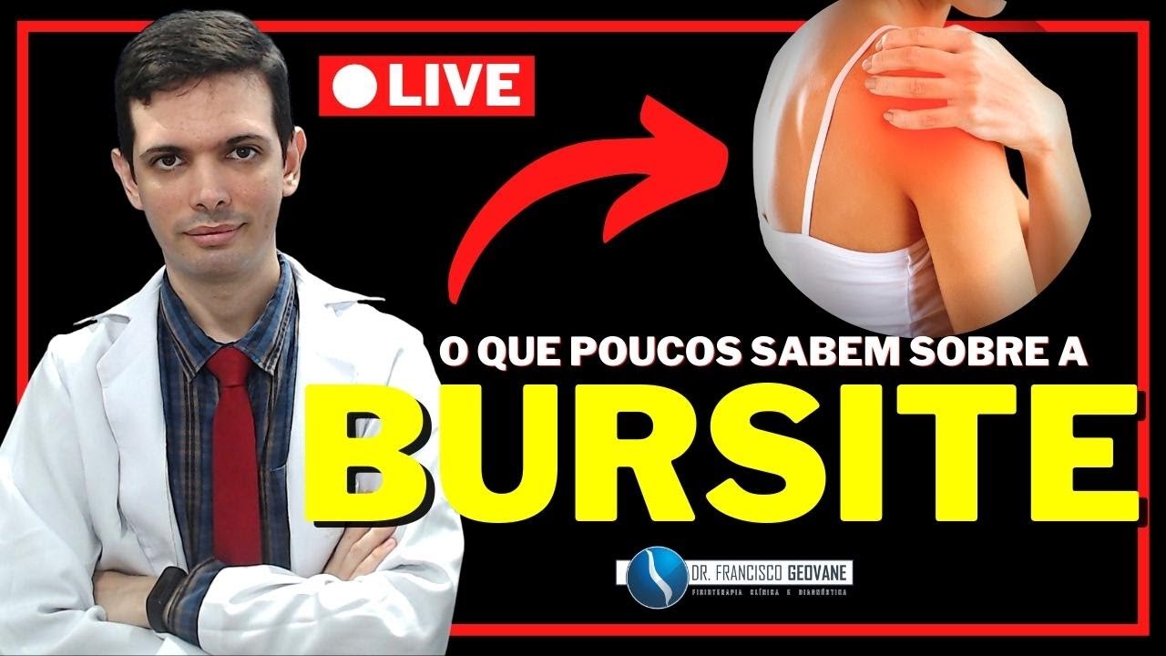 BURSITE SUBACROMIAL - REVELADO o que POUCOS FISIOTERAPEUTAS Sabem ...