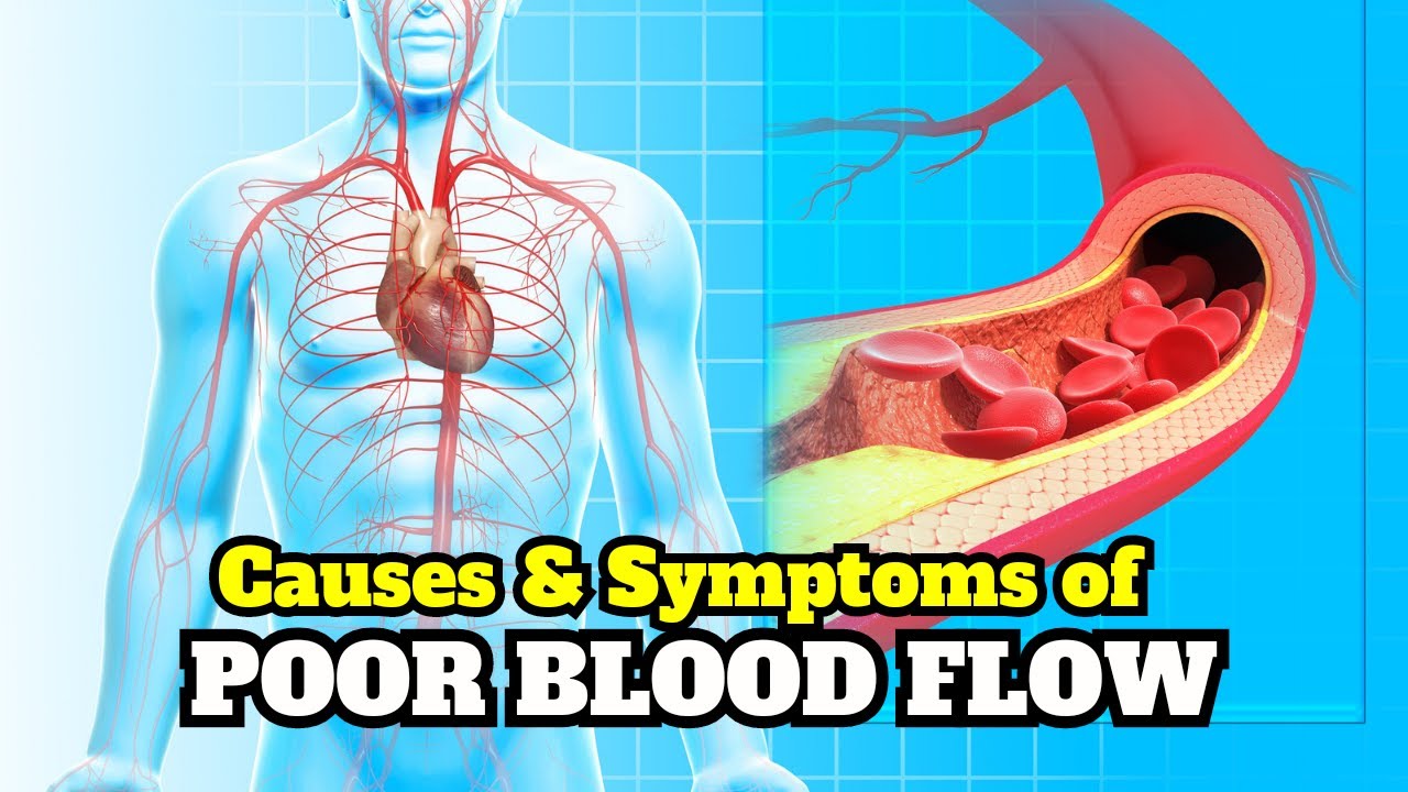 Causes & Symptoms of Weak Blood Circulation | Learn How to Overcome ...