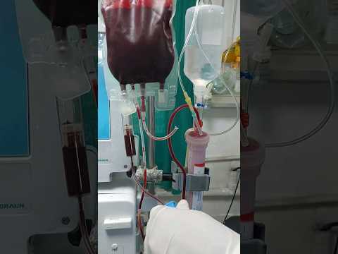 How To Recover Product After Dialysis Bag