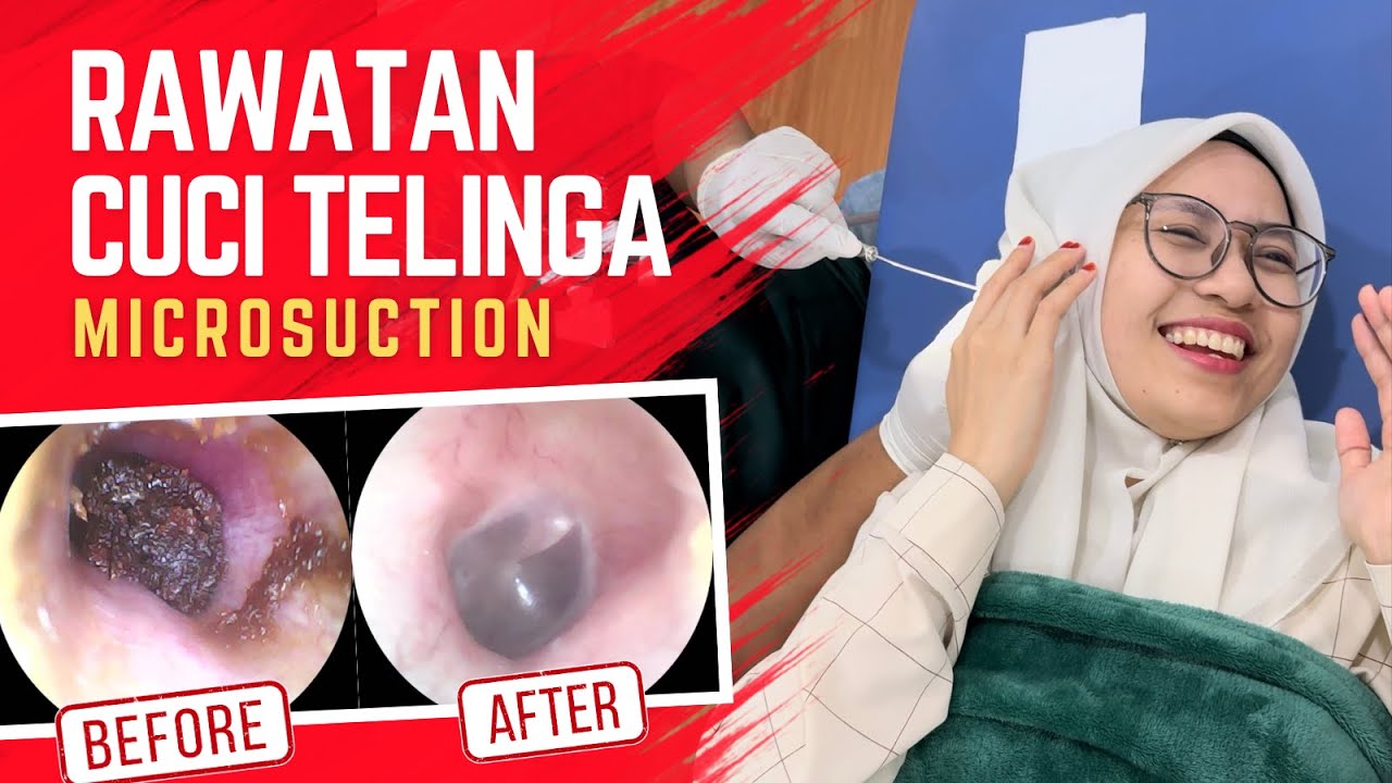 Rawatan Cuci Telinga Tersumbat? - Tak sangka ada klinik buat rawatan ...
