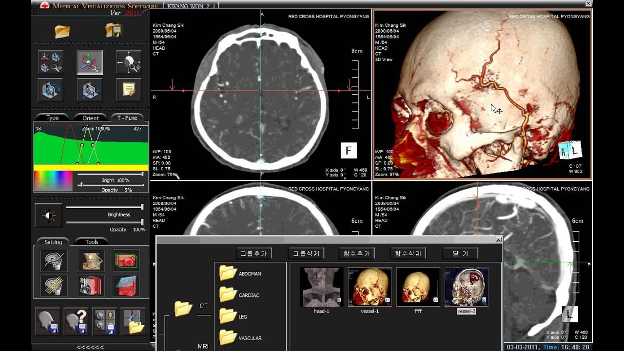 3D Medical Video Diagnosis System - YouTube