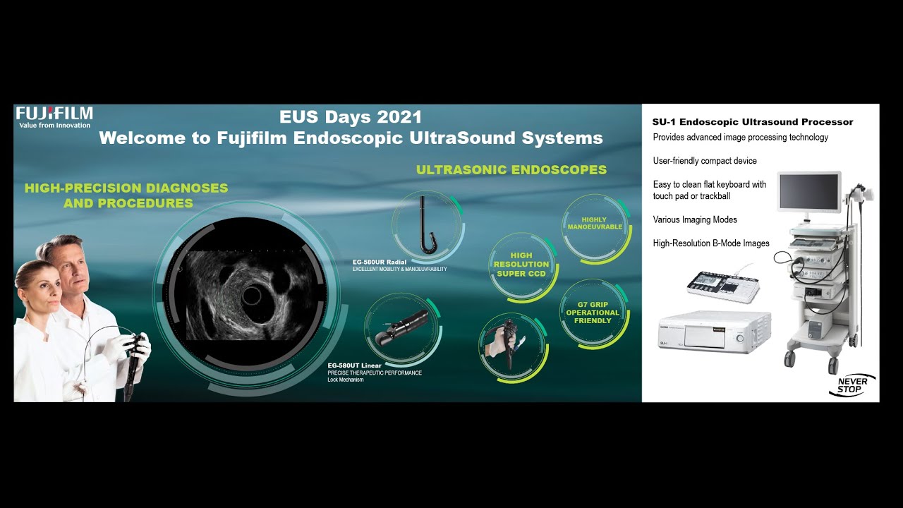 Fujifilm EUS Video : SU1 - Endoscopic Ultrasound System - YouTube