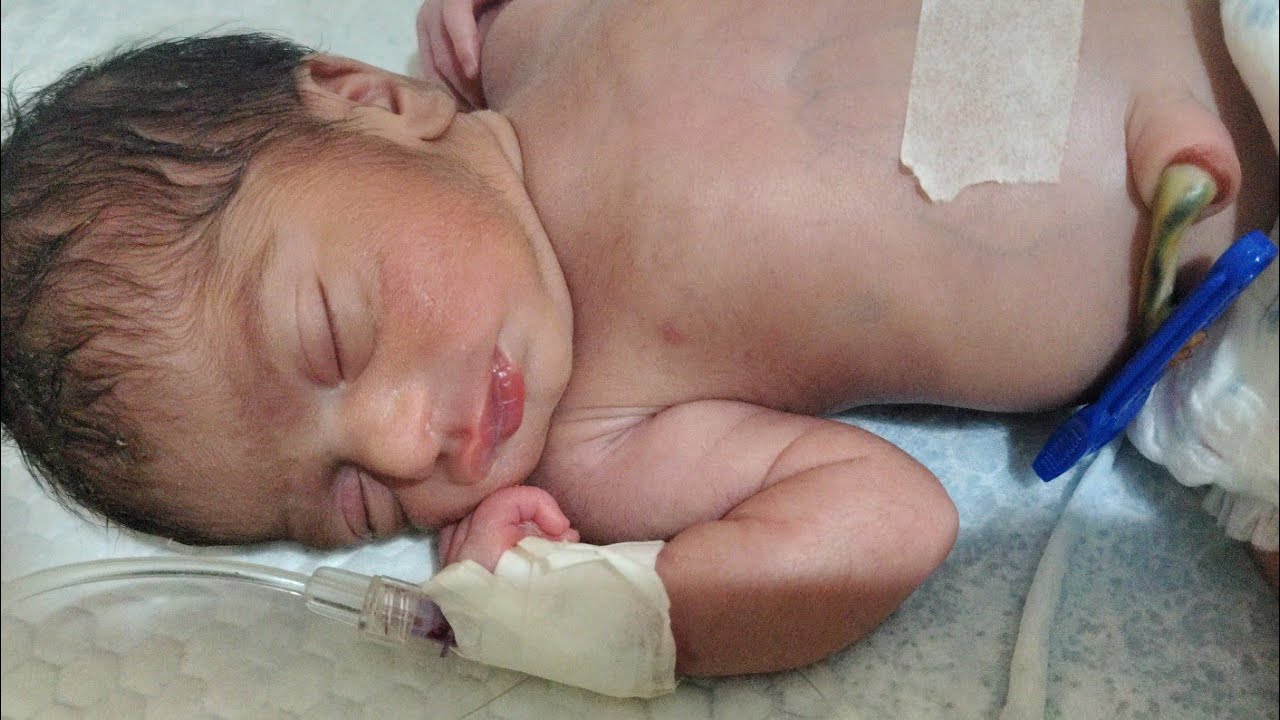 Small baby🧑🏾‍🔬 Baby girls in NICU care 🚼 Time with cutest perimatune ...