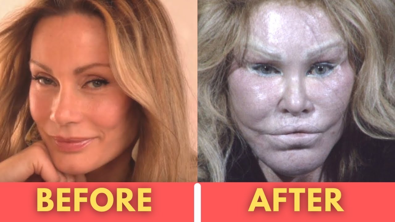 Unrecognizable Actors Who Changed Their Looks / Stars Who Ruined Their ...