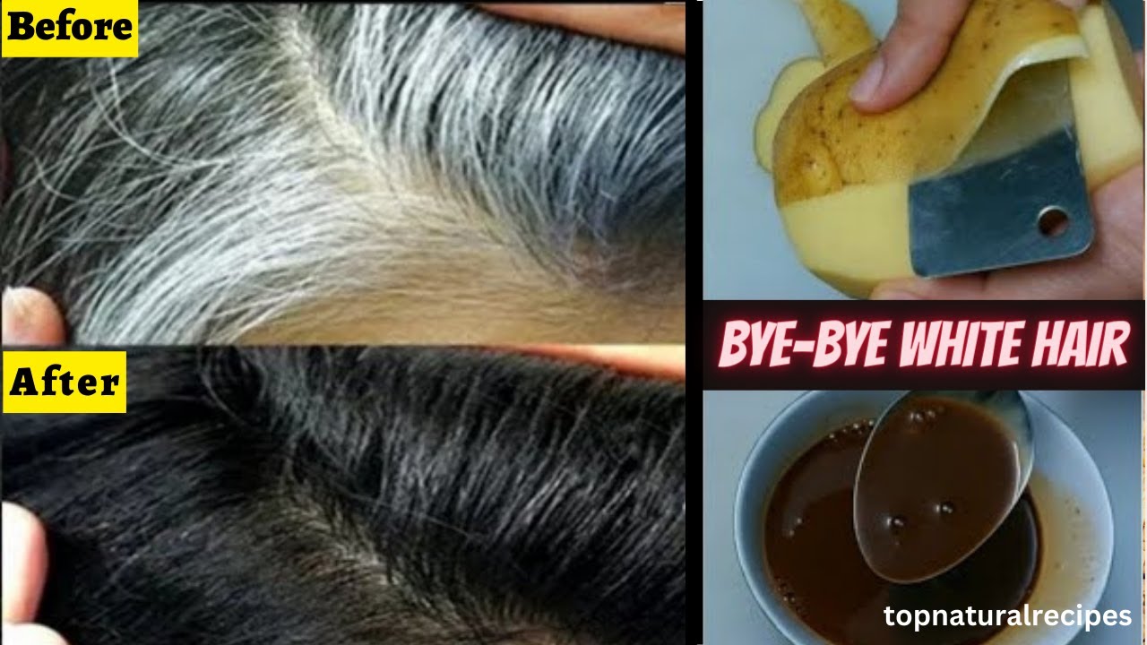 White Hair To Black Hair Naturally in Just 4 Minutes! Potato Peel Hair ...