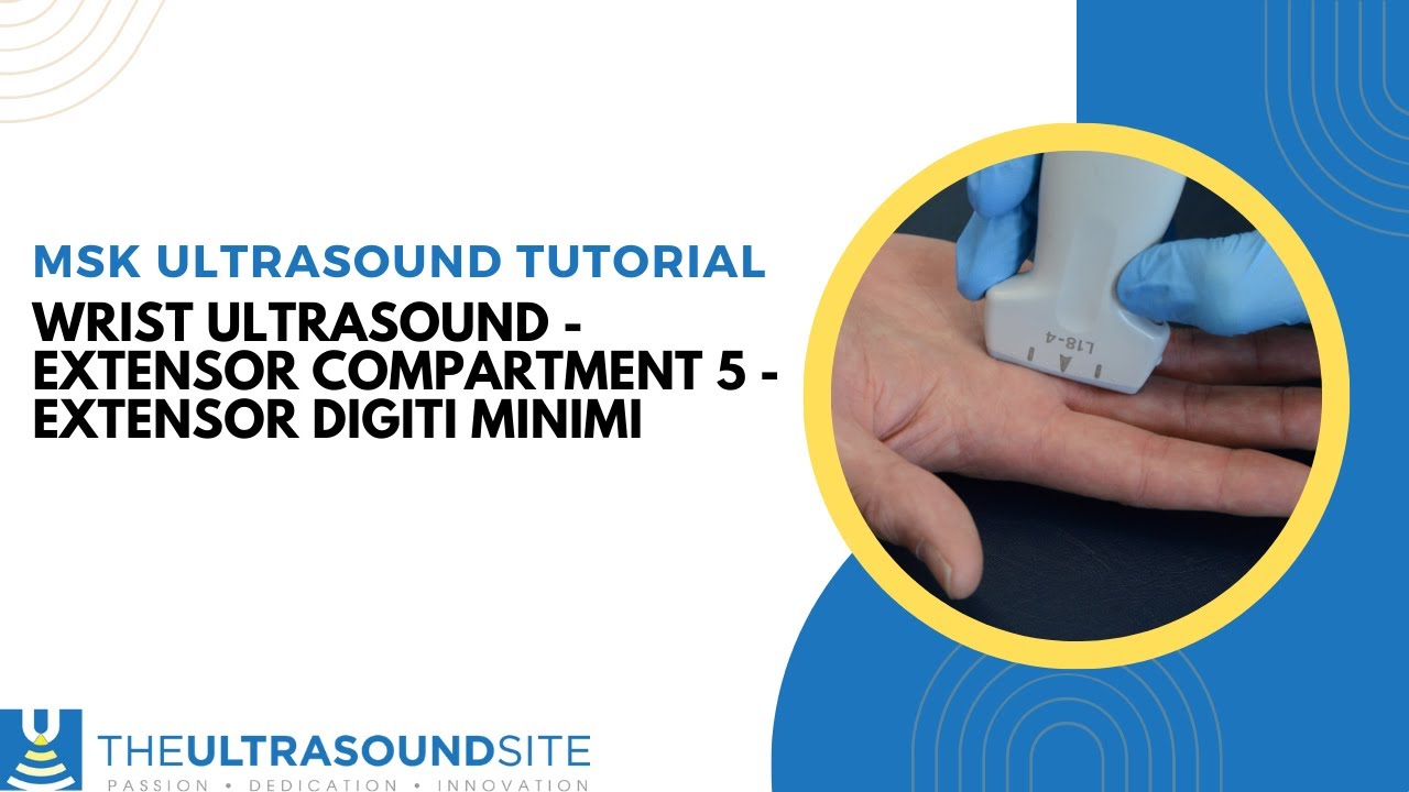 Dorsal wrist ultrasound-Extensor compartment 5(Extensor digiti minimi ...