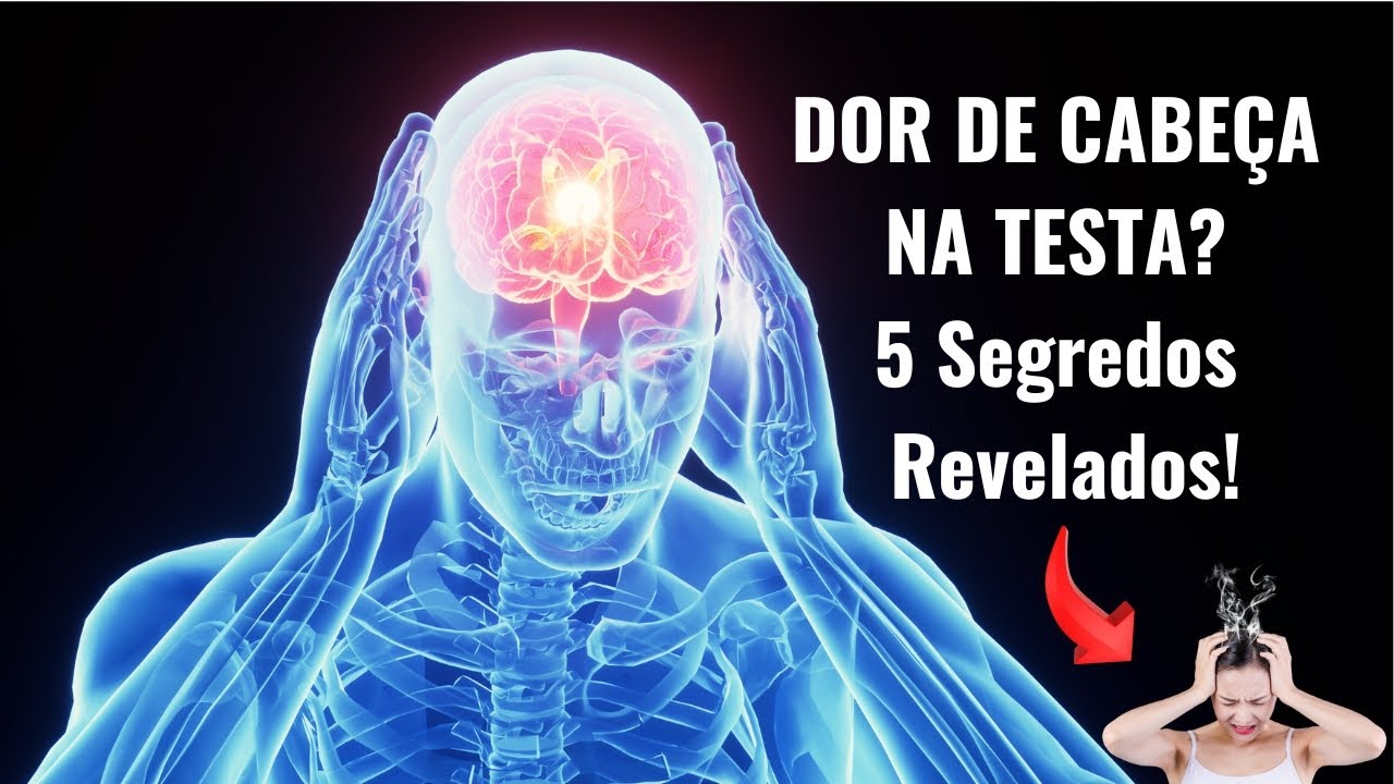 5 Segredos Chocantes Sobre Sua Dor de Cabeça na Testa (O #3 Vai Te ...