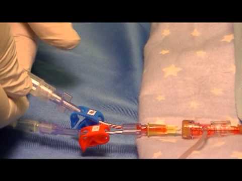 UAC Guidelines using Self-Venting Syringes(VTS_01_1).VOB - YouTube