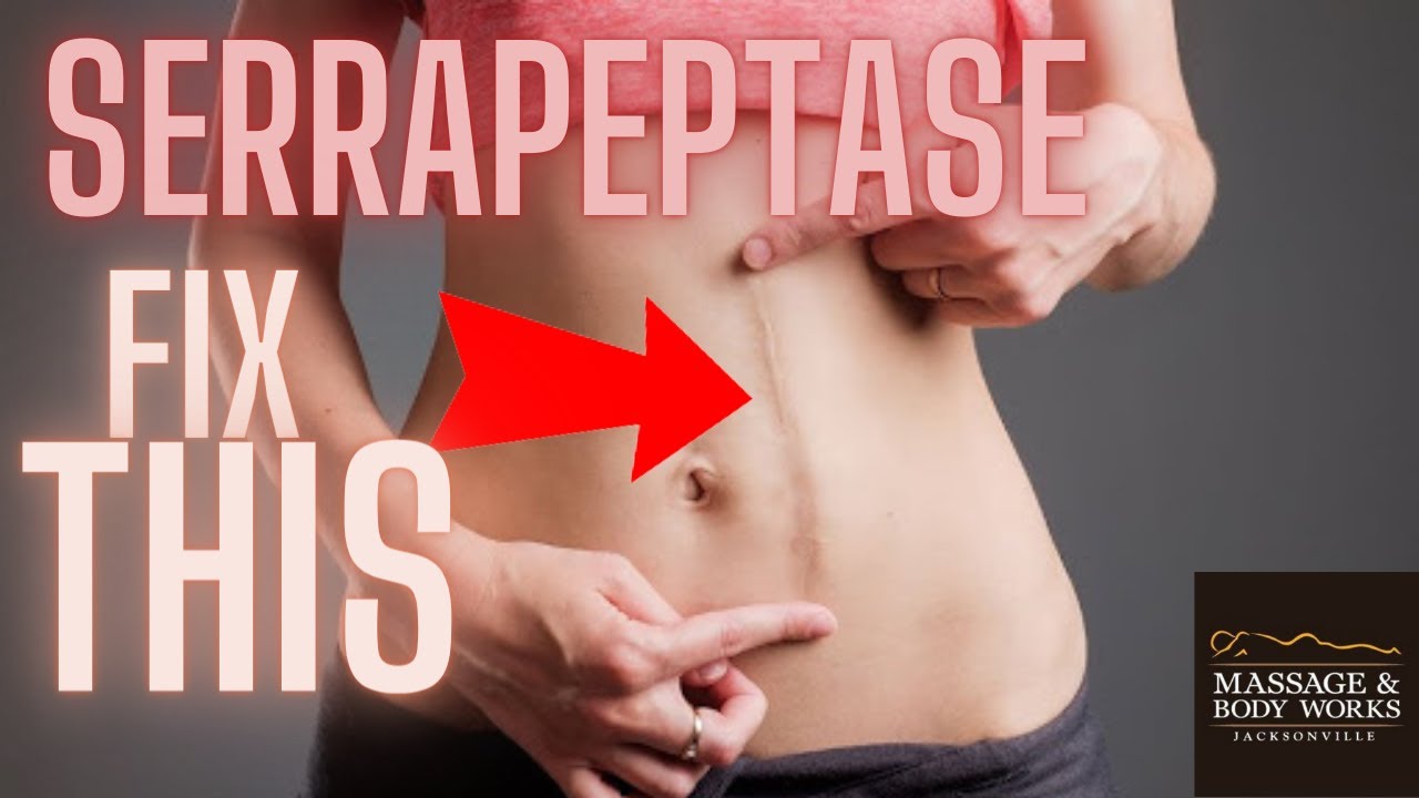 THE AMAZING SERRAPEPTASE - YouTube