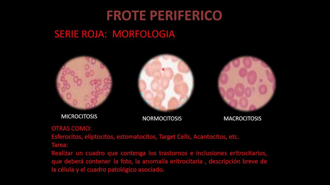 FROTE PERIFÉRICO - YouTube