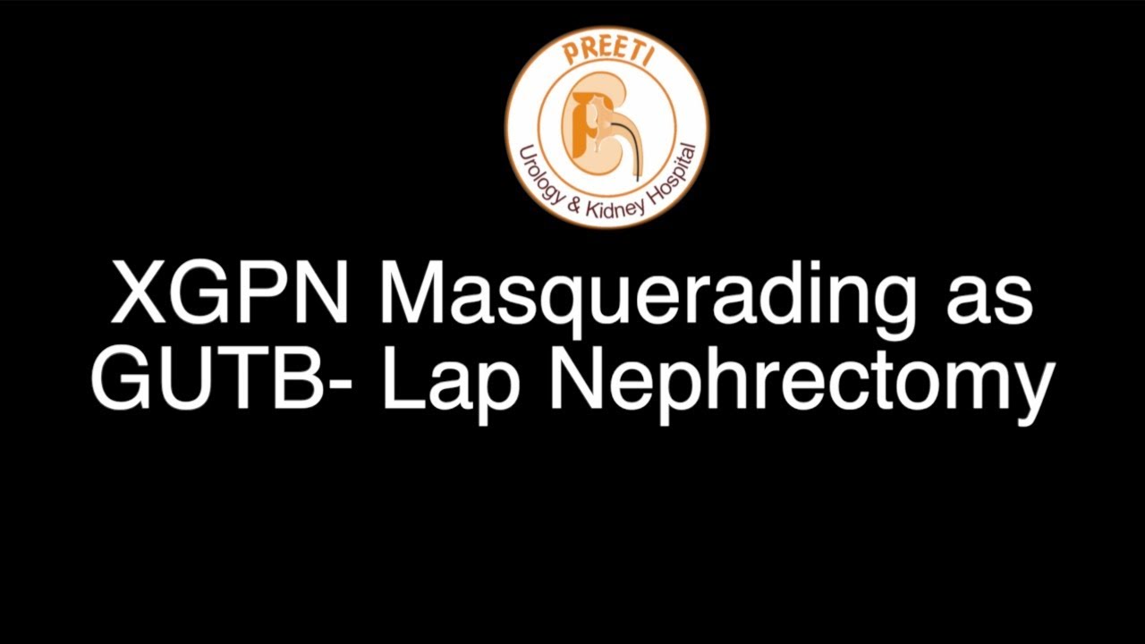 Difficult Laparoscopic Nephrectomy for Pyonephrosis (Edited Video ...