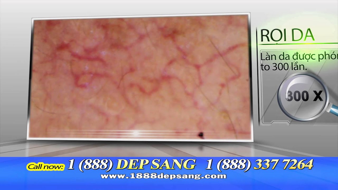 Roi Da's Commercial fo DALLAS VFTV - YouTube