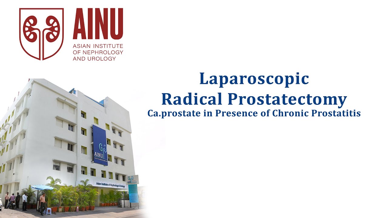 Laparoscopic Radical Prostatectomy - Ca.prostate in Presence of Chronic ...