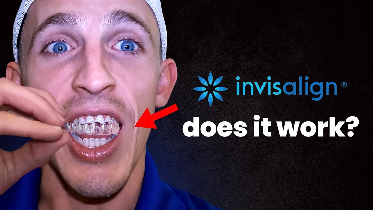 Watch this before you Buy Invisalign…Orthodontist reviews - YouTube