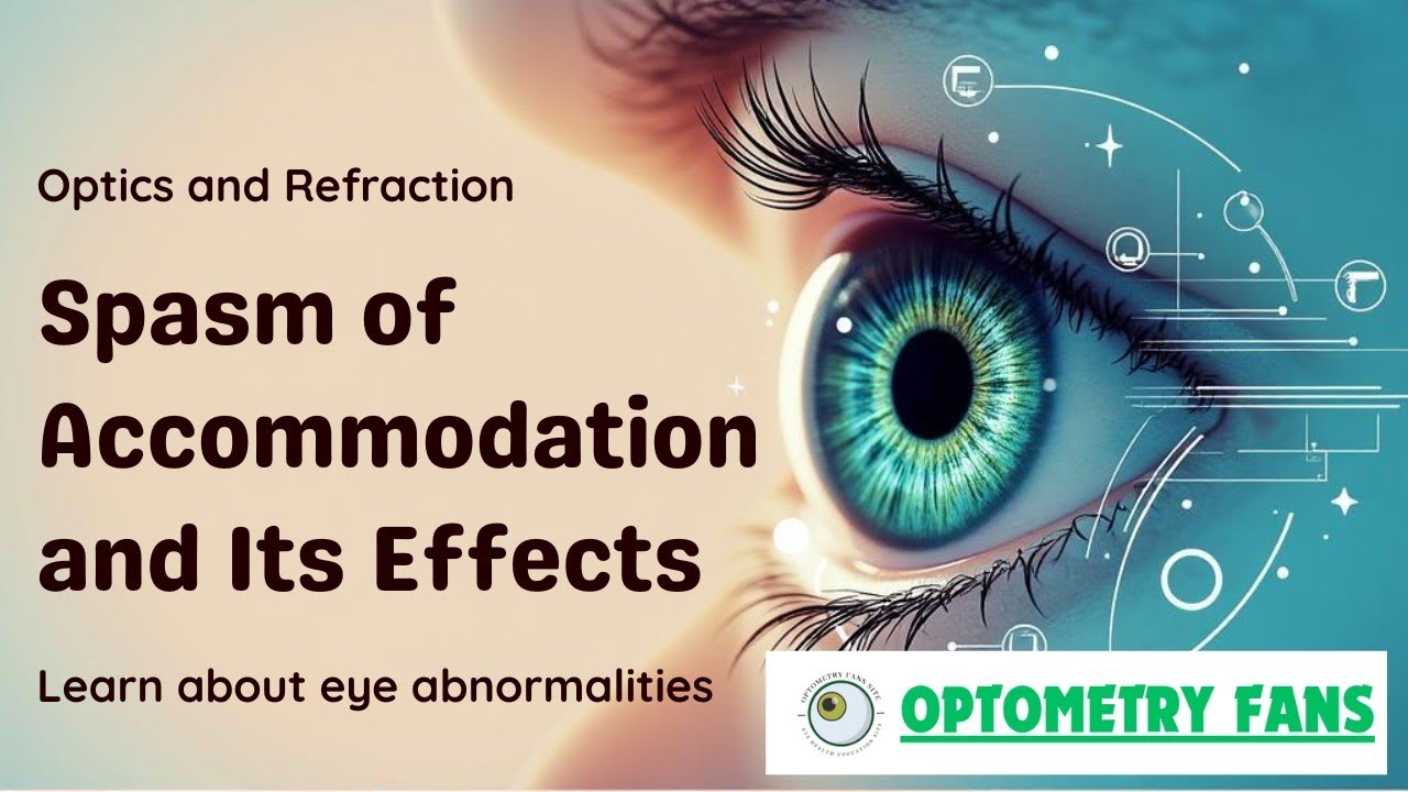 Spasm of accommodation | Abnormalities of accommodation | Optometry ...