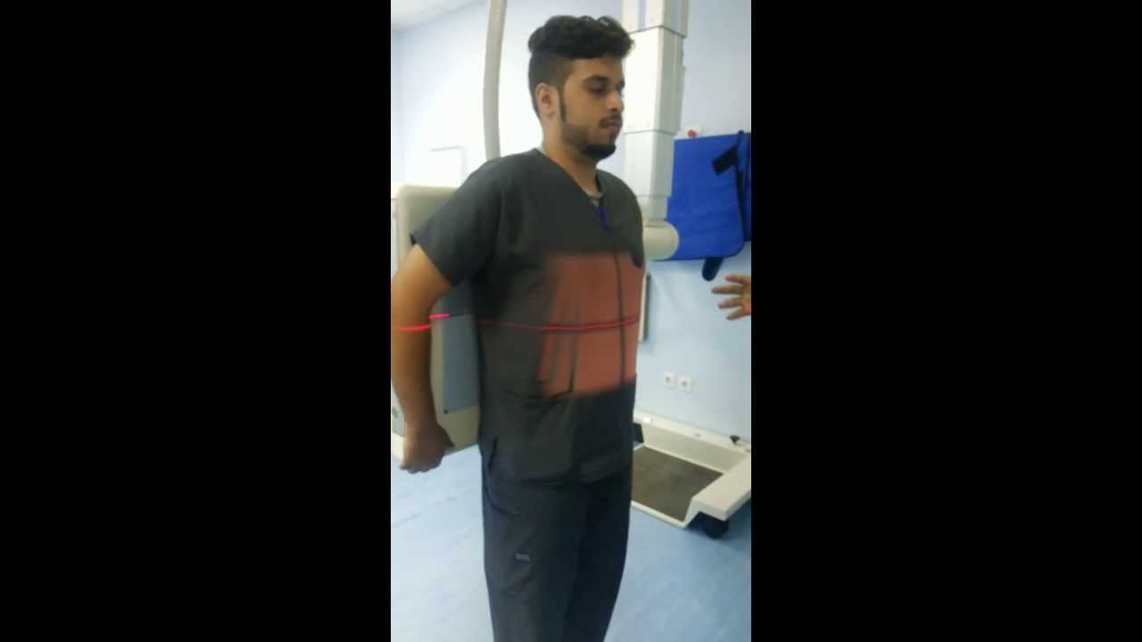 AP Abdomen ( Erect ) - YouTube