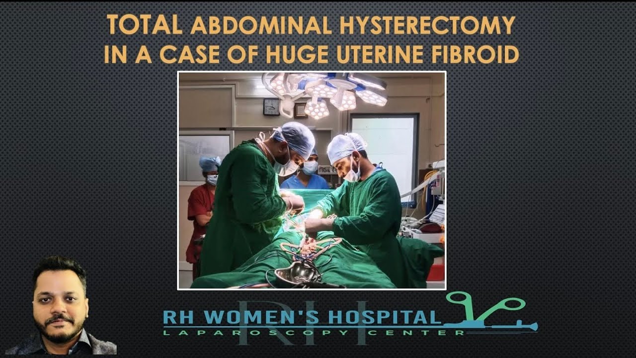 #190 : TOTAL ABDOMINAL HYSTERECTOMY IN A CASE OF HUGE UTERINE FIBROID - YouTube