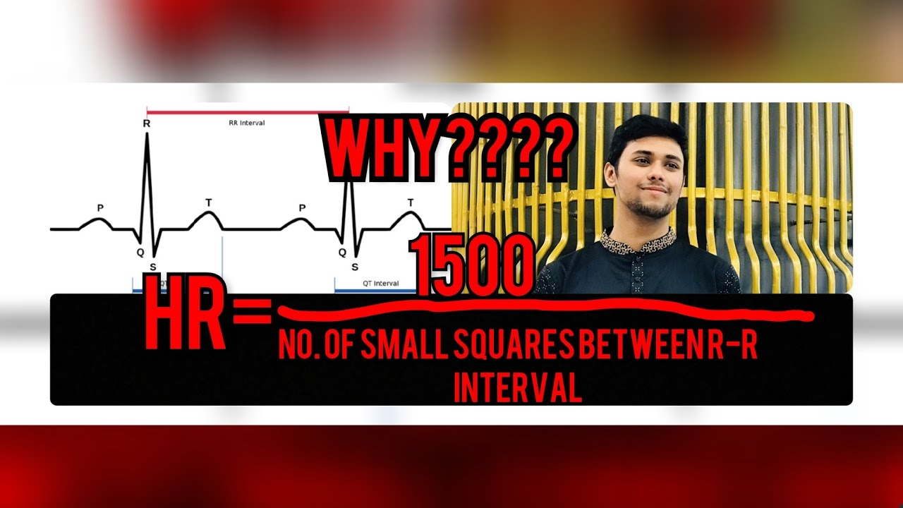 How to determine heart rate using ECG( heart rate-এর সাথে R-R interval ...