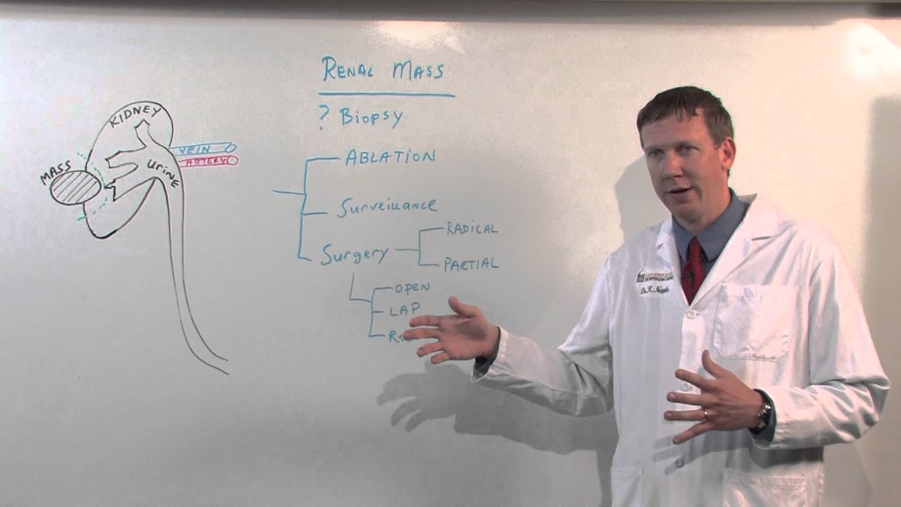 Treatments for Kidney Tumors - Kenneth Nepple, MD - YouTube