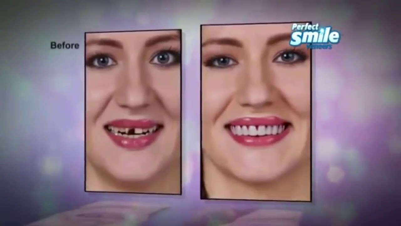 Amazing Zippy Smile® - YouTube