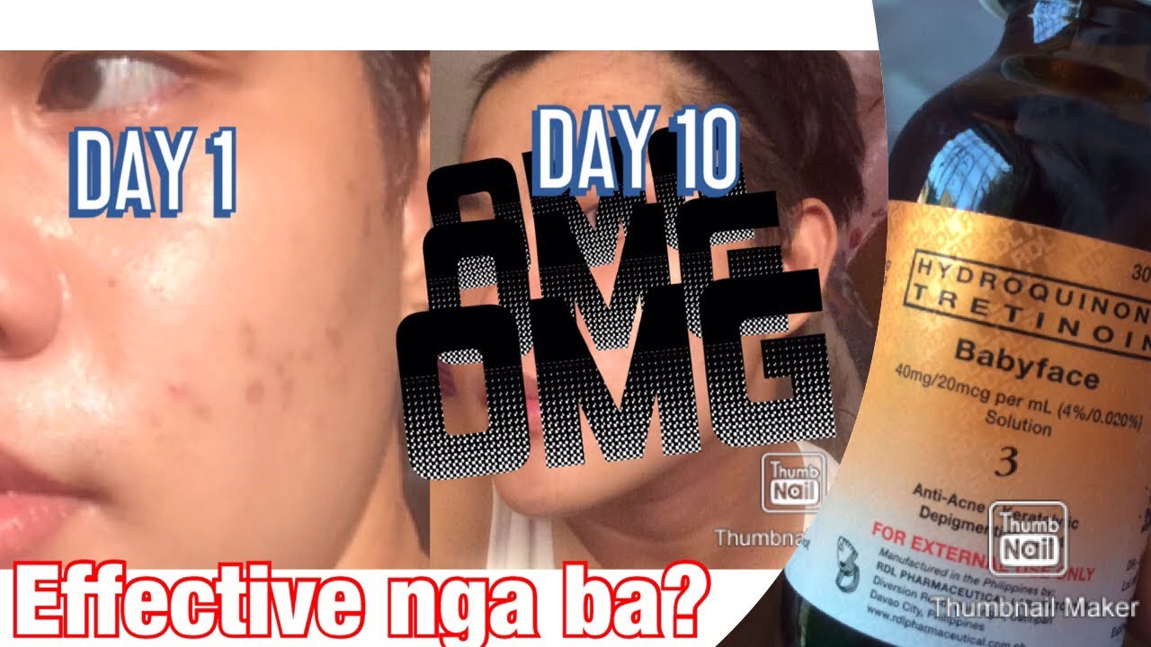 REVIEW OF RDL BABYFACE SOLUTION (EFFECTIVE NGA BA?) | JOSHY WAP - YouTube