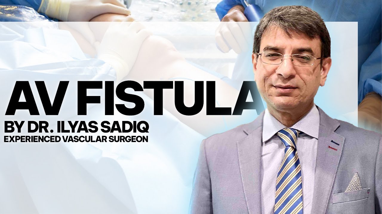 Causes & Treatment Of AV Fistula | Dr. Ilyas Sadiq - YouTube