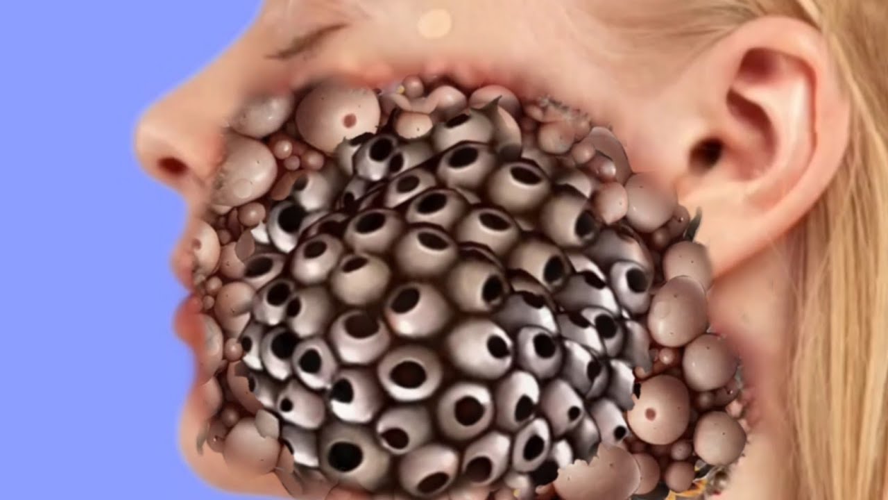 ASMR Animation Treatment Infected 🤧 cheek, cheek treatment Collection ...