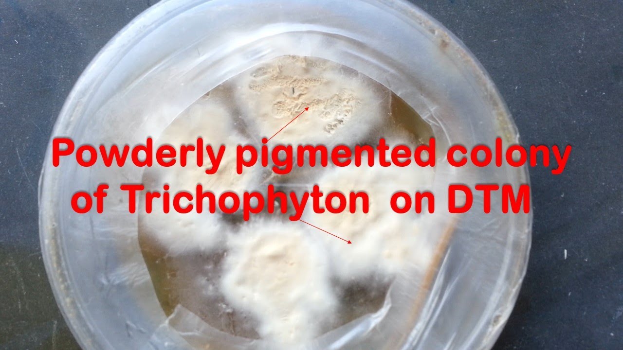 Trichophyton growth on dermatophyte test medium (DTM) Demo - YouTube