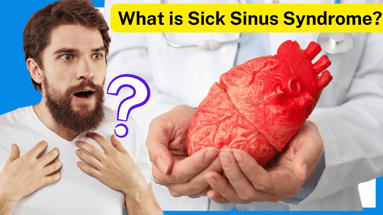 What Is Sick Sinus Syndrome (SSS)? Symptoms, Causes, and Treatment ...
