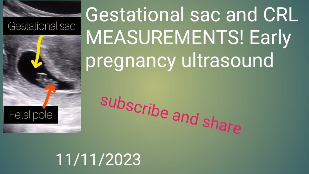Gestational sac and Crl measurements on ultrasound! Pregnancy ...