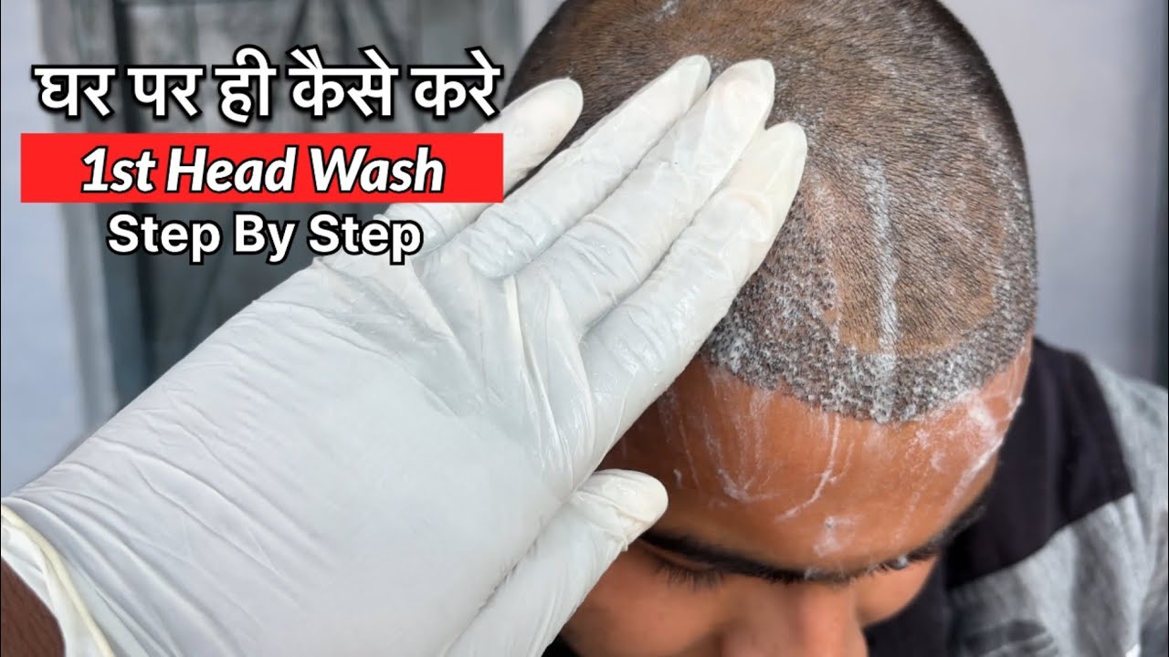 1st Head Wash After Surgery | घर पर Head wash कैसे करें | Detailed ...