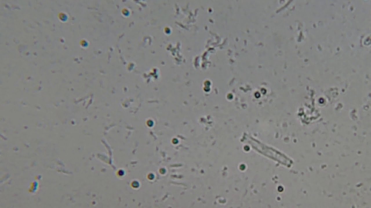 coccus, diplococci, staphylococci, bacilli (бацилла, палочка ...