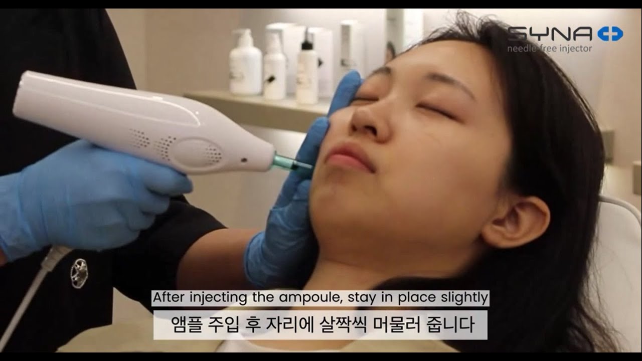 Synaplus Treatment - YouTube