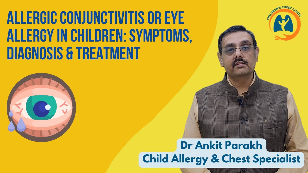 Allergic Conjunctivitis, Eye Allergy in children: Symptoms, diagnosis ...