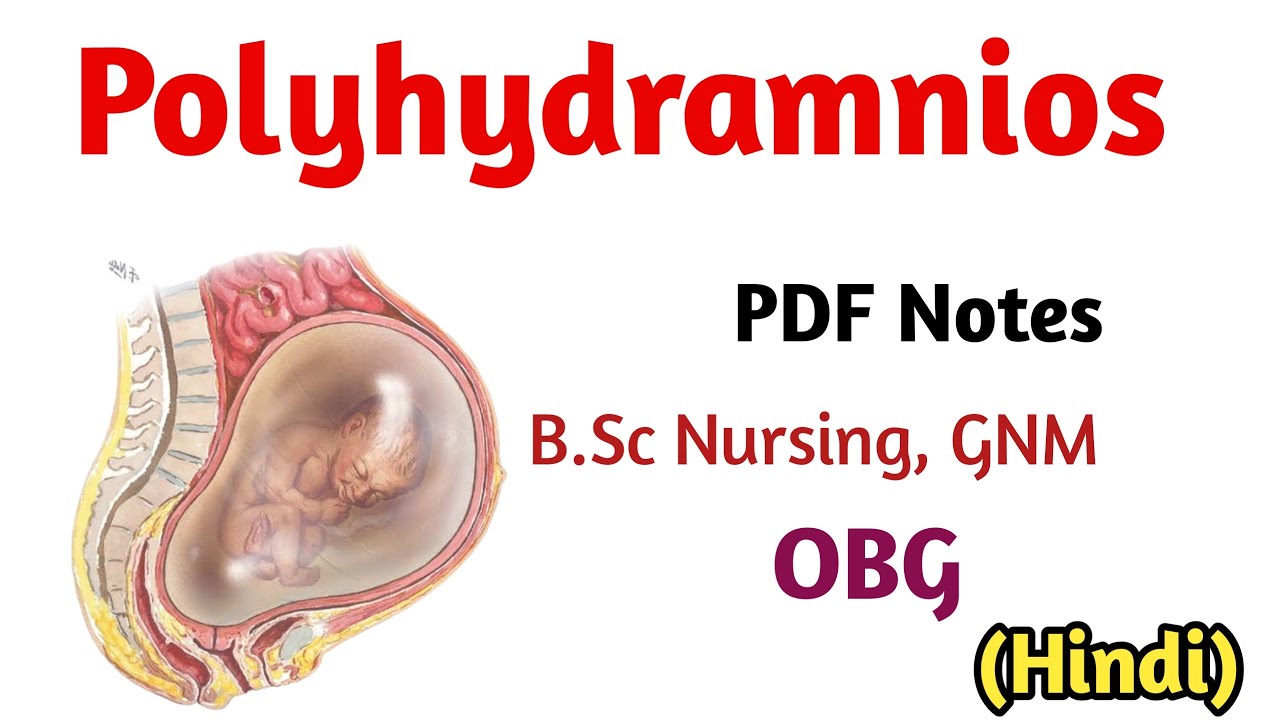 Polyhydramnios Pregnancy | Polyhydramnios | Polyhydramnios in Hindi ...